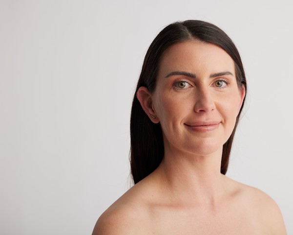 Microneedling - Marion Plastic Surgery